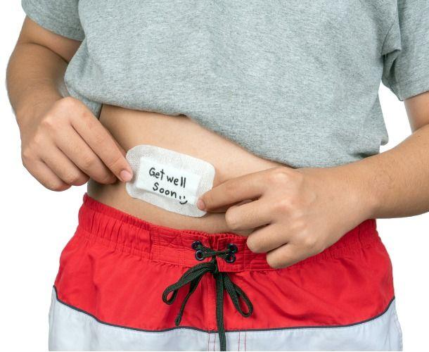 Verbandswechsel PEG-Sonde und Sondenpflege