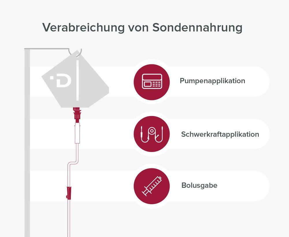 Enterale Ernährung einfach erklärt: Definition, Vorteile, Anwendung
